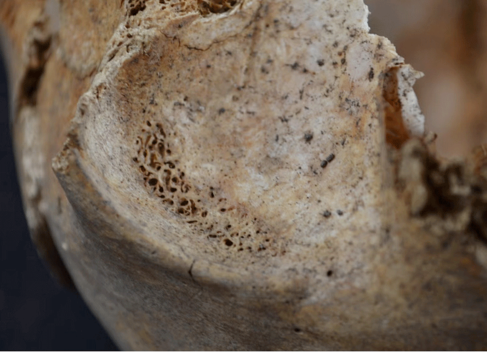 Study: Cranial Lesions Signs of Compromised Immune Function | UCSB ...